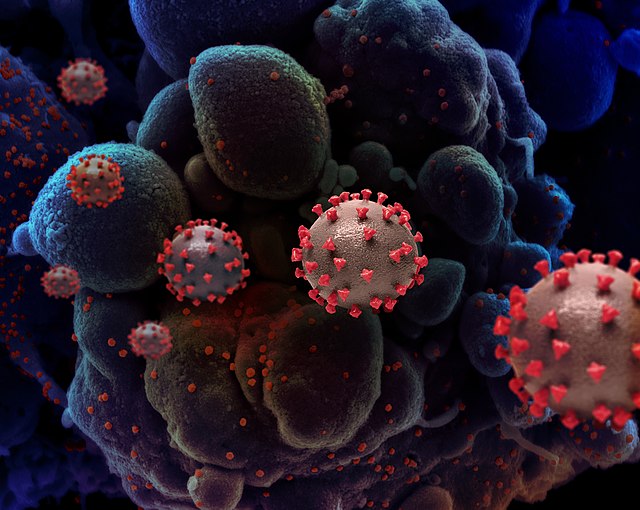 U.S. Congressional Report Backs Lab-Leak Theory for COVID-19 Origins